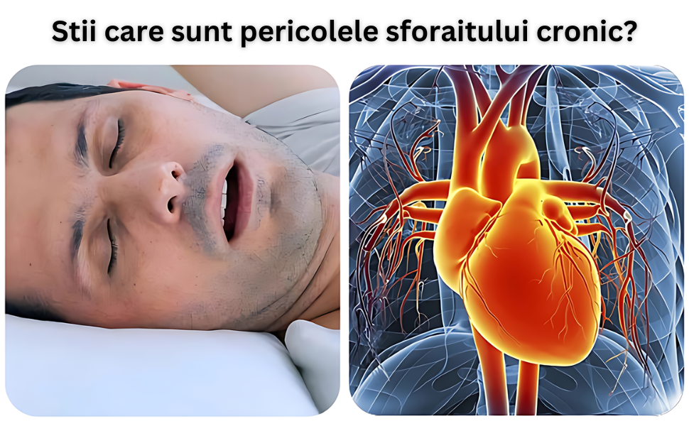 Dispozitiv Inteligent Anti-Sforait, petriSALEx®, detecteaza automat ...