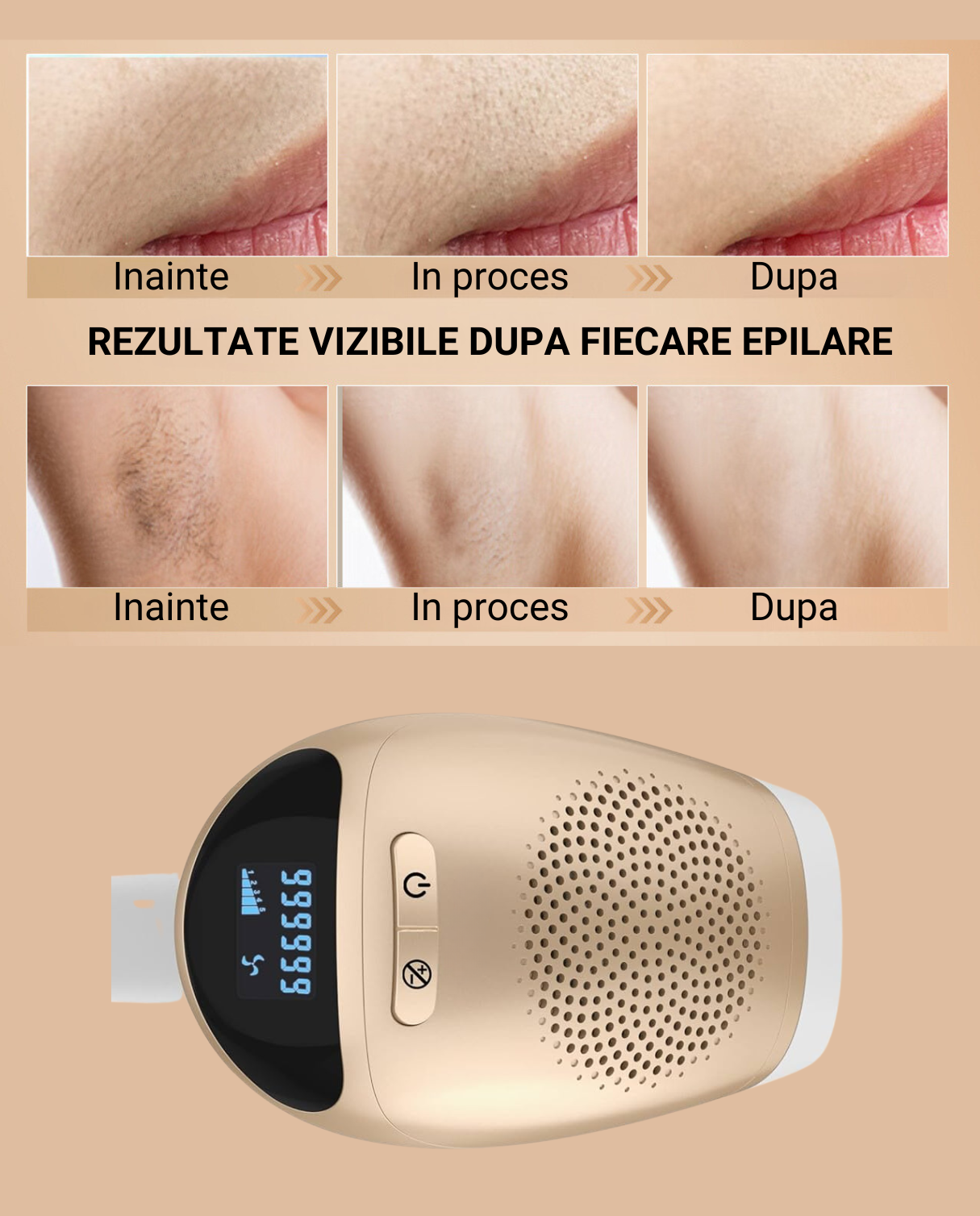 Epilator IPL Pentru Epilare Definitiva Profesionala, ProHink ...