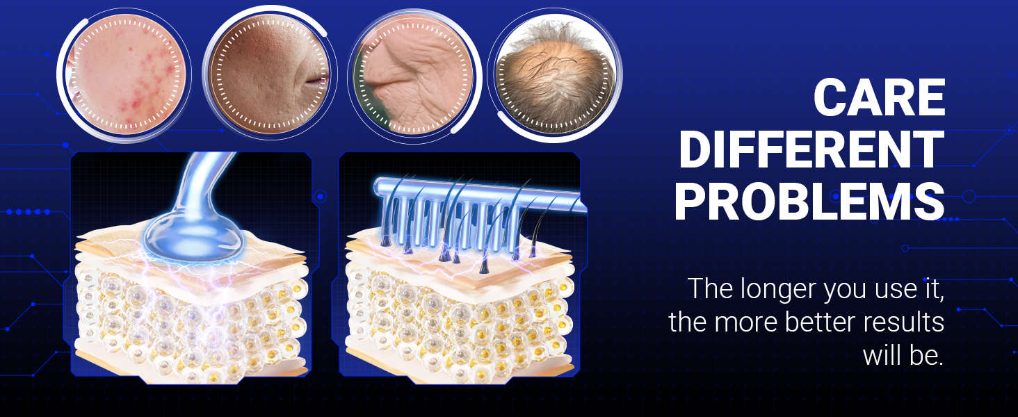 Aparat Electroderm pentru tratament cosmetic，SHIJOOE®，portabil, ，Tehnologie cu Argon de Inalta ...